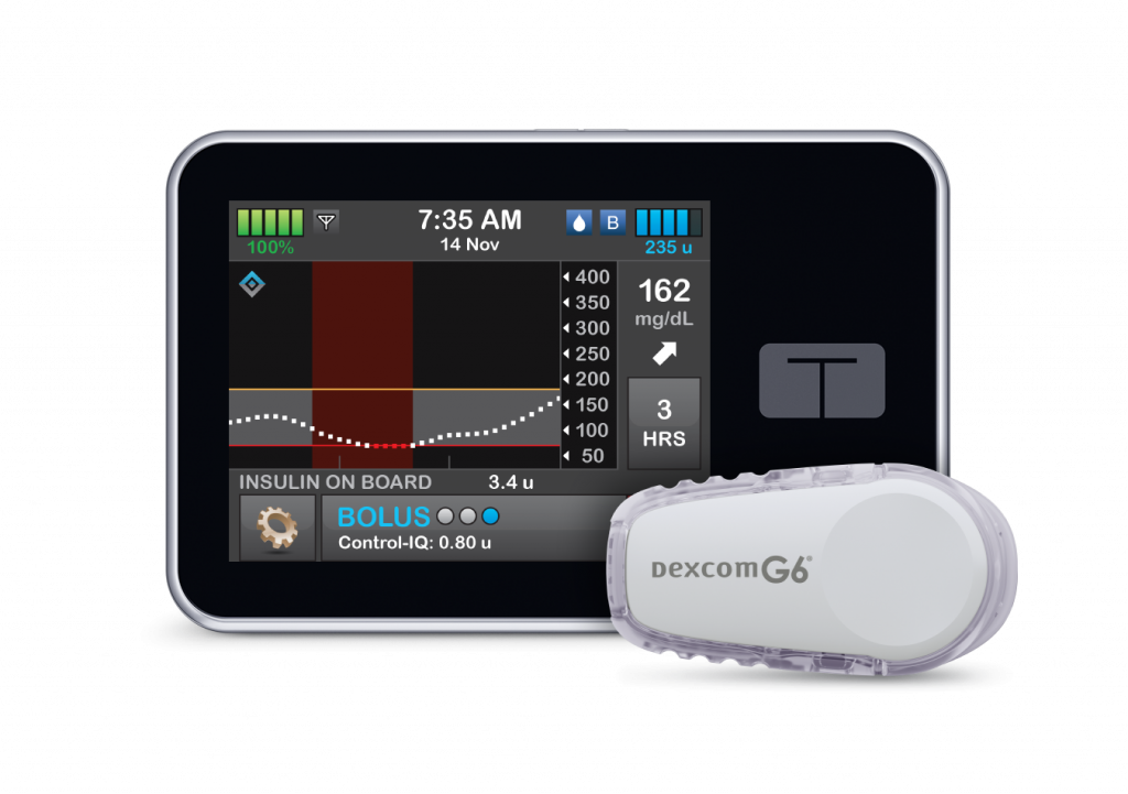 closed-loop insulin pump Archives - T1D Exchange