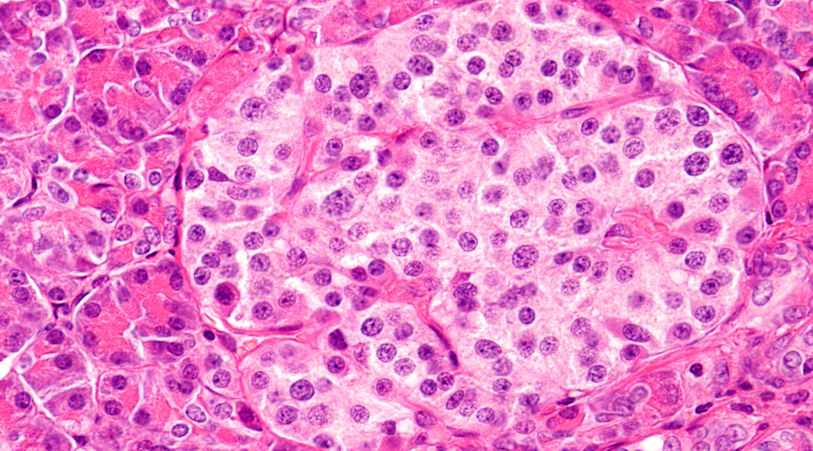 Vertex Pharmaceuticals Pursues Investigational Cell Therapies for Type ...