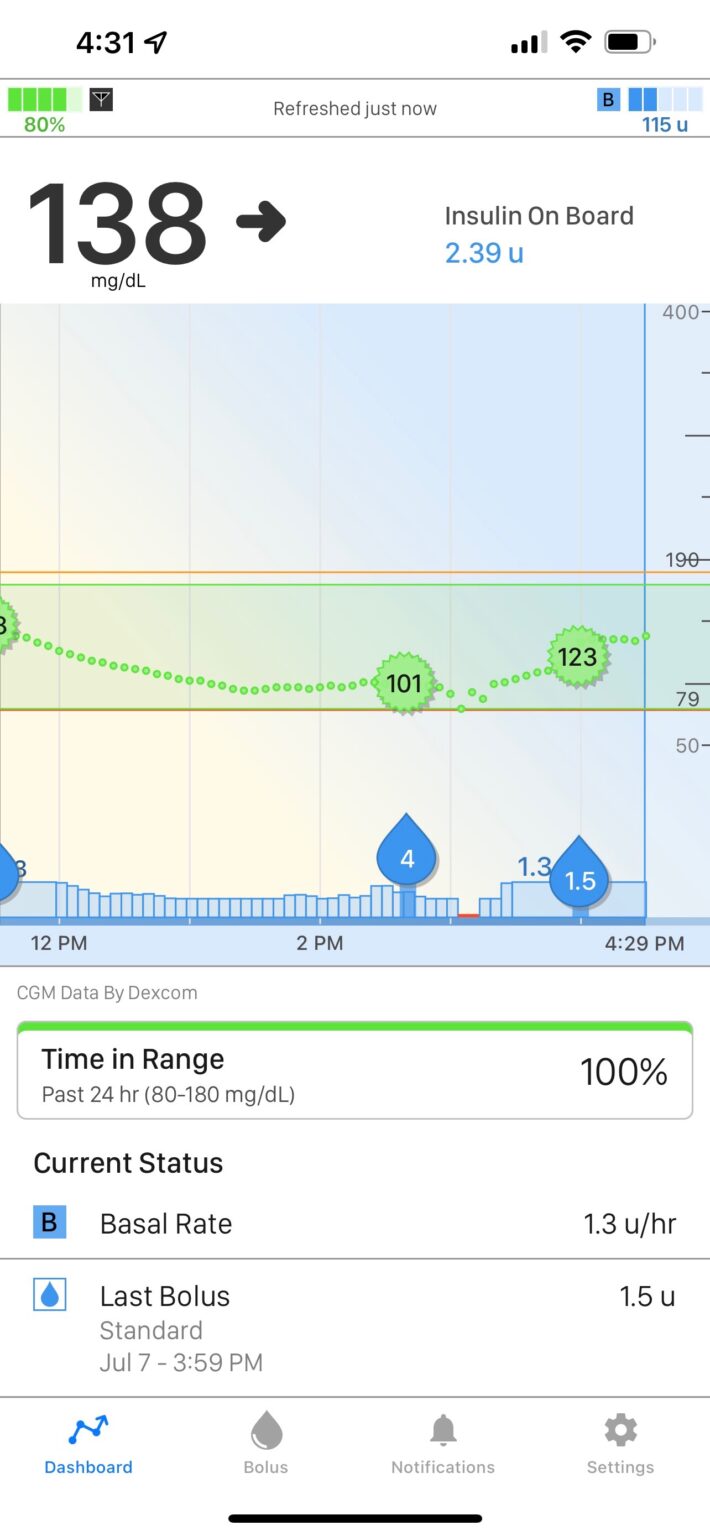 Time-in-Range: Making the Most of Your CGM Data - T1D Exchange